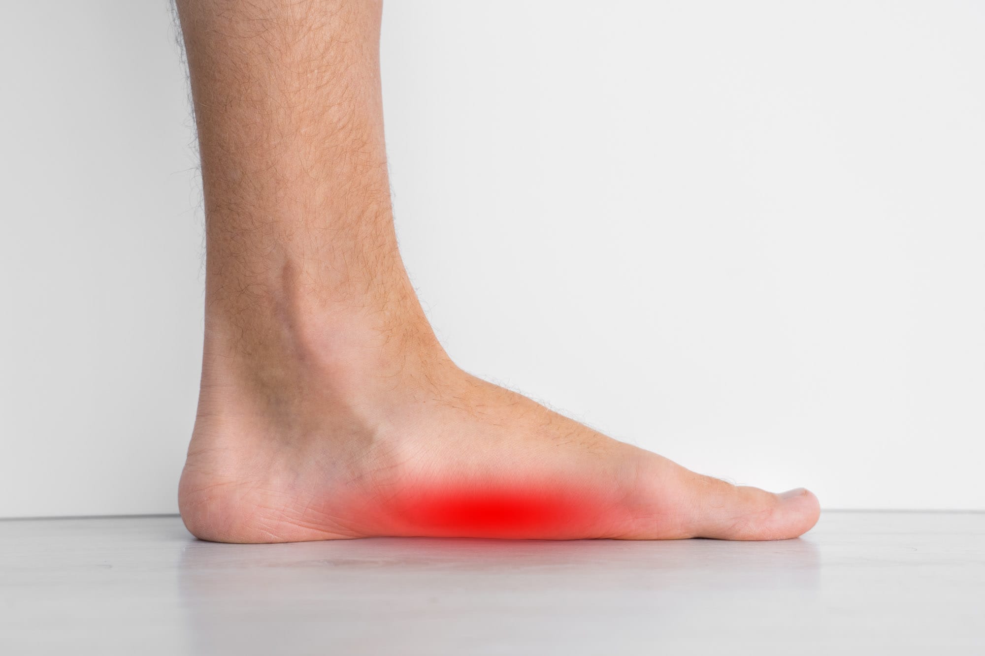 Flat Feet And Fallen Arches: A Quick Guide From Our Adelaide ...